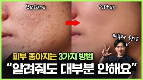 이걸 모두가 알면 피부과 다 망해요😭 의사들이 숨기고 있다는 집에서 피부 관리하는 방법 Youtube