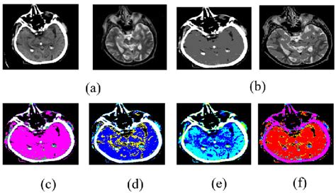 A Input Images B Segmented Images Fused Images C With Pso D With