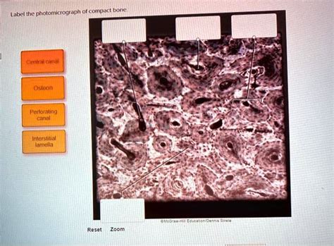 Label The Photomicrograph Of Compact Bone Central Canal Osteon Perforating Canal Interstitial