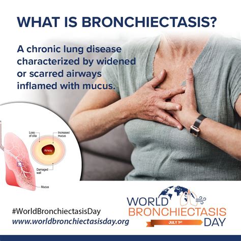 Worldbronchiectasisday Bronchiectasis Healthylungs Lunghealth