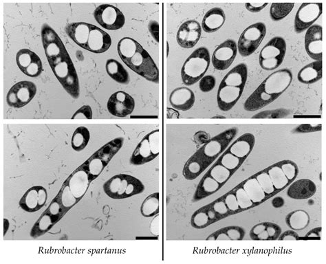 Microorganisms Free Full Text The First Insight Into Polyhydroxyalkanoates Accumulation In