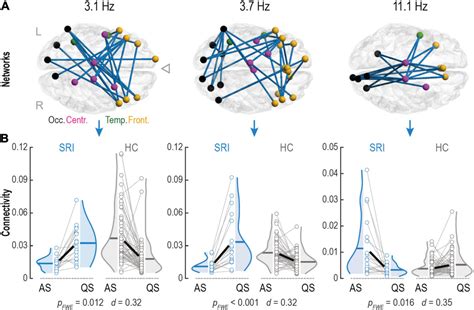 Frontiers Cortical Cross Frequency Coupling Is Affected By In Utero Exposure To Antidepressant