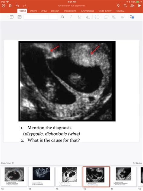 Solved iPad令 4 54 AM 66 105 Revision 105 copy semi Home Chegg com