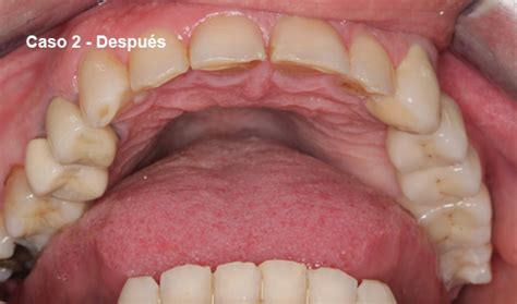 Rehabilitacion Oral Odontología Especializada