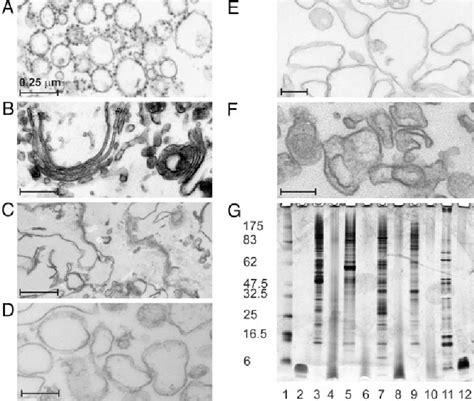 Basolateral Plasma Membrane Semantic Scholar