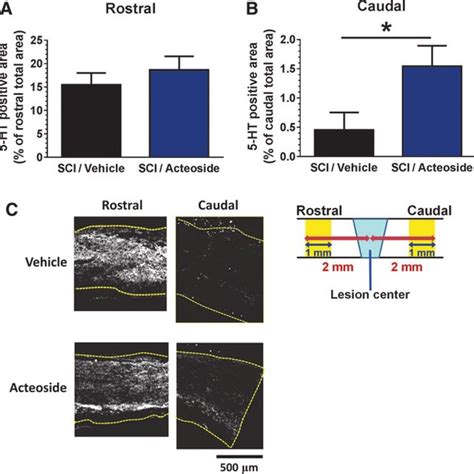 Acteoside Effects On Axonal Growth At The Lesion Site Of Mice With Download Scientific Diagram