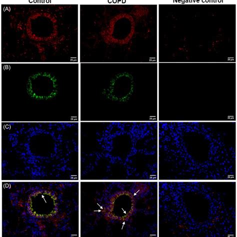 Immunofluorescence Staining Of Il‐17 Rorγt Double Positive Cells In Download Scientific