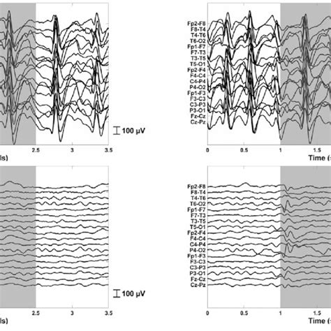 Example Of An EEG Sample In Three Different Montages Shown Is An Download Scientific Diagram