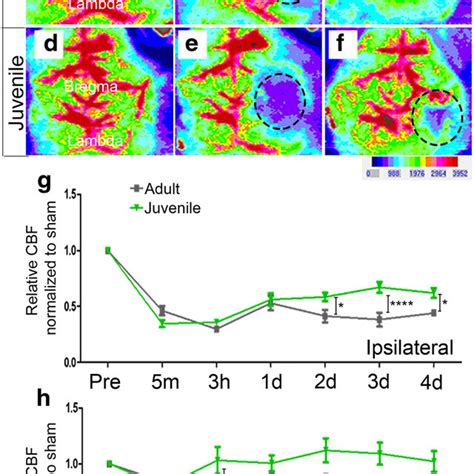 Age At Injury Influences Restoration Of Cbf Following Cci Injury Cbf