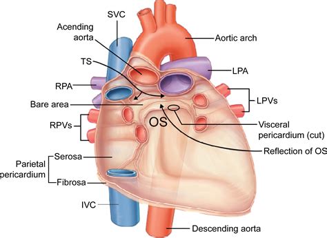 Oblique Pericardial Sinus