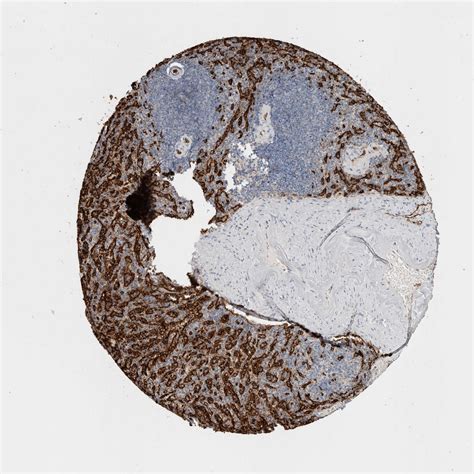 Tissue Expression Of Cd36 Staining In Spleen The Human Protein Atlas