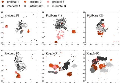 Figure 2 From Learning Robust Features From Nonstationary Brain Signals By Multiscale Domain