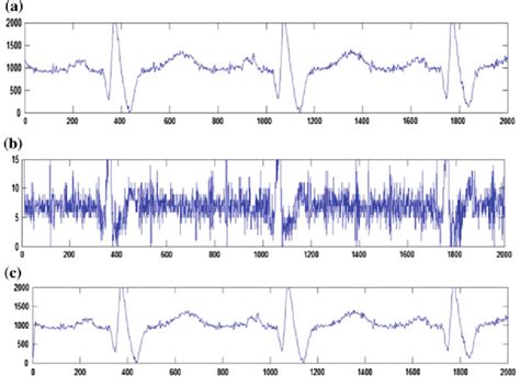 Dpcm Technique A Original Ecg Signal B Encrypted Ecg Signal C