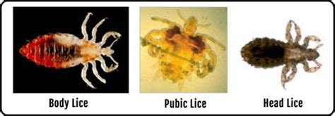 Differences Among Head Lice Body Lice And Pubic Lice LiceDoctors