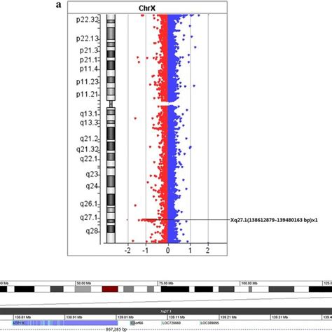 Chromosome Karyotype Of The Patient The Sex Chromosomes Of The Patient Download Scientific