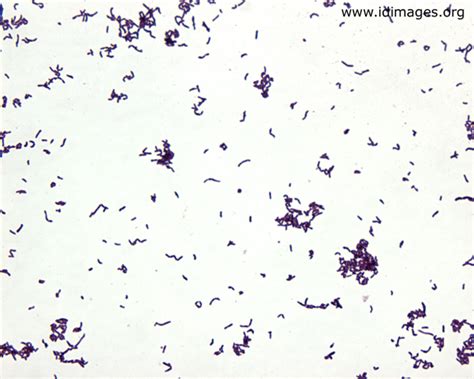 Infectious Disease Images Emicrobes Digital Library Images