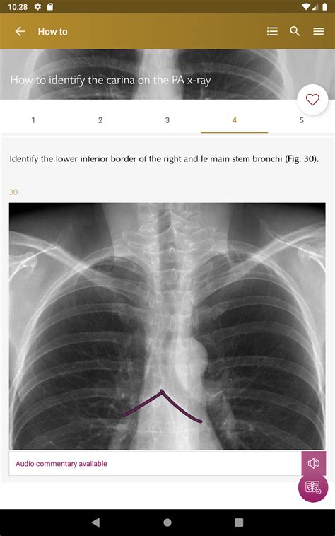 Discover Radiology Chest X Ray Interpretation Apk สำหรับ Android