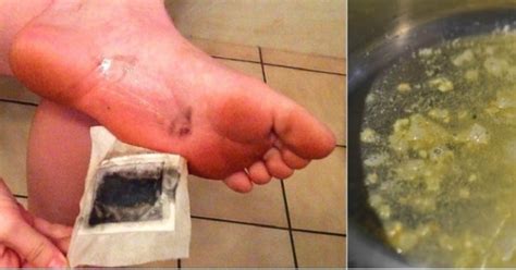 Правиш го вечер а през нощта изкарва всички токсини от тялото през краката Отлепваш и си нов