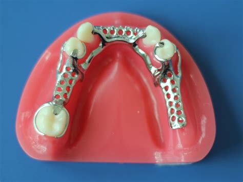 Dental Lab China Dental Laboratory China China Outsourcing Dental Lab Dental Lab Chinese