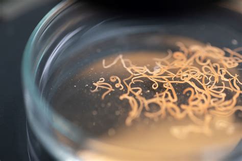 Investigation Underway After Hookworm Found In Lowndes County
