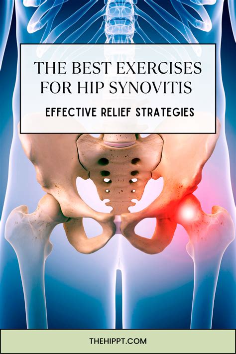 The Best Exercises For Hip Synovitis Effective Relief Strategies The