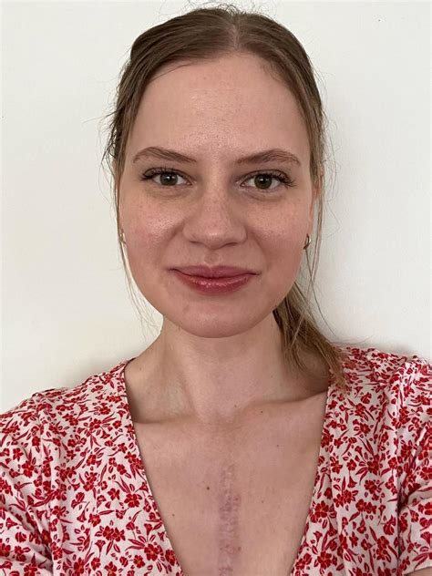 Georgie Cauchi Battling Bowel Cancer After Multiple Heart Surgeries Daily Telegraph