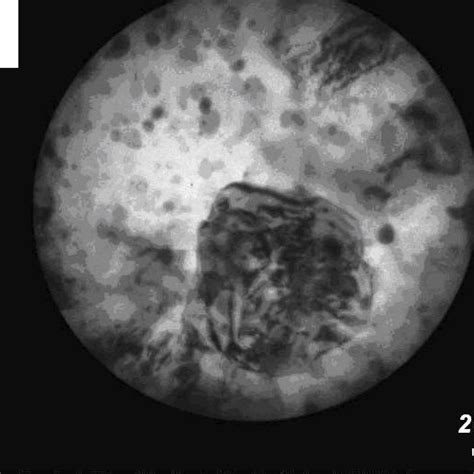 A B Typical Microstructure After Ecap At 150 ºc 6 Passes