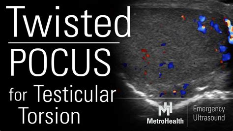 What Is A Twisted Testicle Called At Erik Cox Blog