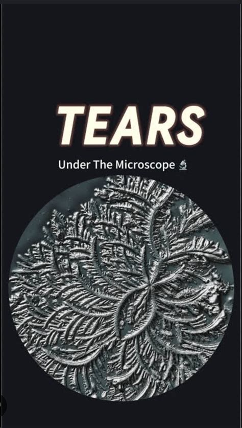 Tears Under Microscope Actually Look Like Rudraksha Rhinduism