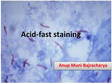 Acid Fast Staining Pdf Chemistry Science