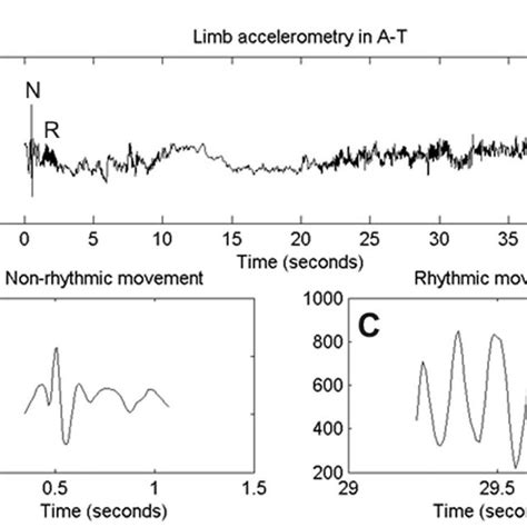 Accelerometry From One A T Subject During Postural Condition Composite Download Scientific
