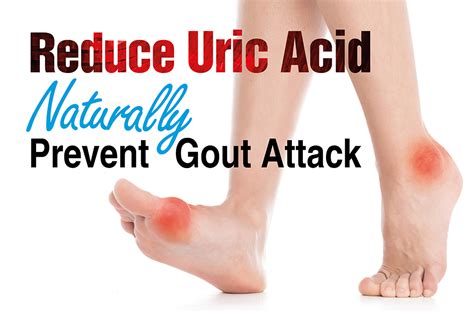 Uric Acid Crystal Harmony