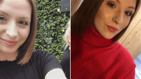 Heres What Its Really Like To Get Botox In Your 20s Metro News