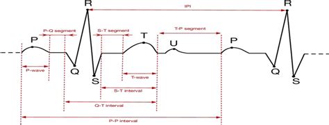 Block Diagram Of An Ecg Signal [3] Download Scientific Diagram