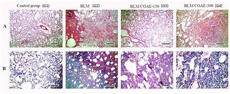 Evolution Of Histological Alteration Of Lung Rat After Blm Instillation Download Scientific