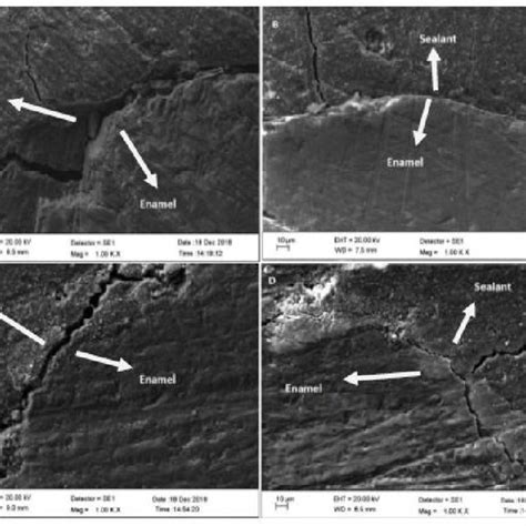 Microleakage Presence According To Enamel Conditioning Download Scientific Diagram