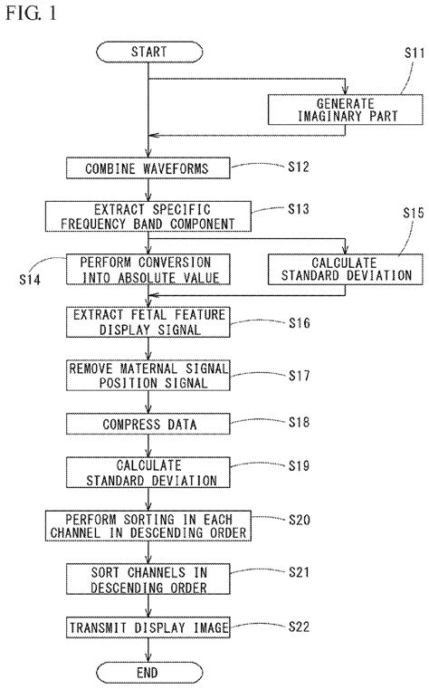 fetal electrocardiographic signal processing method and fetal electrocardiographic signal