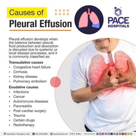 Pleural Effusion Causes Symptoms Diagnosis And Treatment