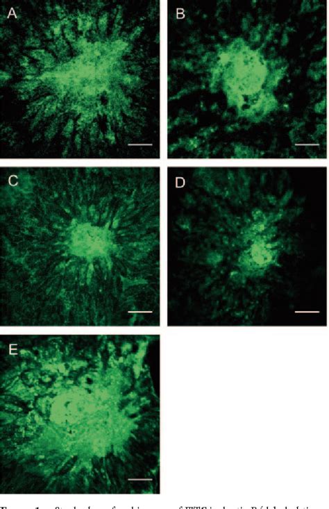 Figure 1 From Inhibition Of Laser Induced Choroidal Neovascularization By Atorvastatin By