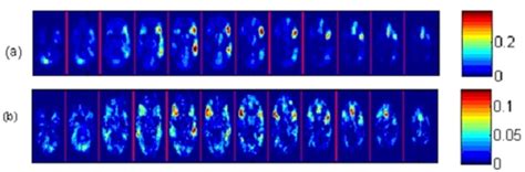 Integrating Nonlinear Decision Functions With Principal Component Analysis In Fmri Language
