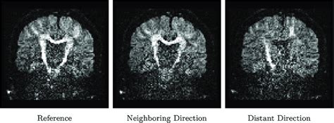 Diffusion Weighted Images Scanned At Different Gradient Directions The