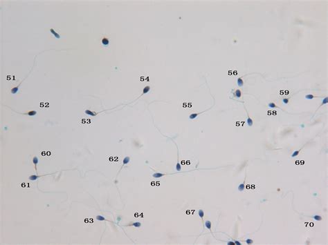 How To Use Python And Opencv To Achieve A Well Edge Detection To