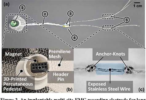 Figure 1 From Edge Ai Based Closed Loop Peripheral Nerve Stimulation