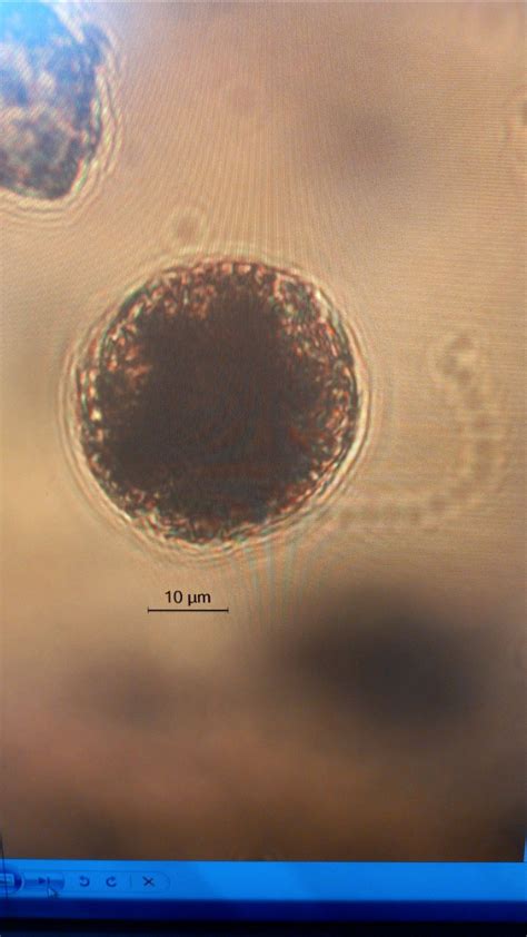 Coolia Monotis Observed Under Inversed Microscope Asmae Bennouna