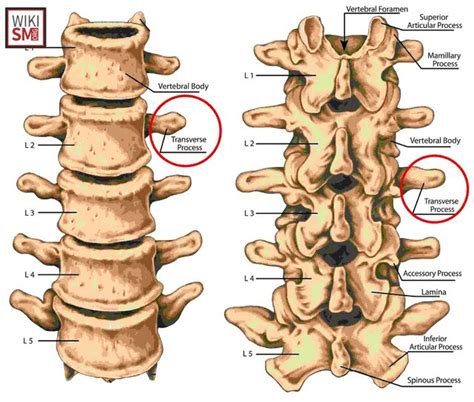 Transverse Process Fracture Wikism Sports Medicine Wiki