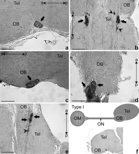Brain Sections Showing Fmrfamide Immunoreactive Ir Nervus Terminalis