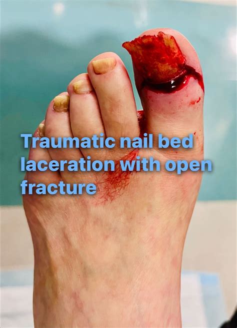 Improve Mohammad K Islam Md Dpm Aabfas Aacfas