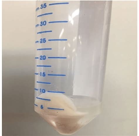 A Picture Of A Biopolymer Containing Falcon Before Cell Mass Separation Download Scientific