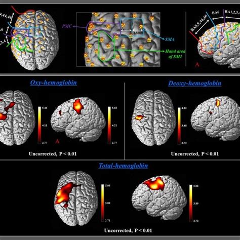 A Four Regions Of Interest Based On The Brodmann Area BA And Download Scientific Diagram