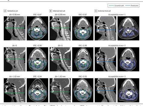 figure 1 from development and validation of an automated image based